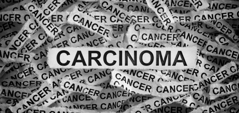 All About Basal Cell Carcinoma | Skin And Cancer Institute - Blog