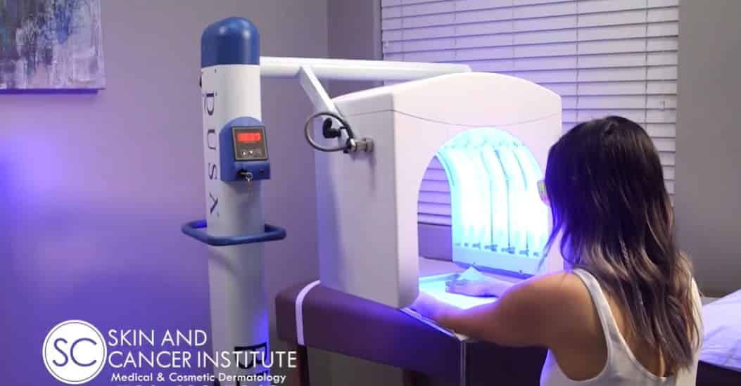 Levulan Kerastick + Blu-U for Actinic Keratoses | Skin And Cancer Institute