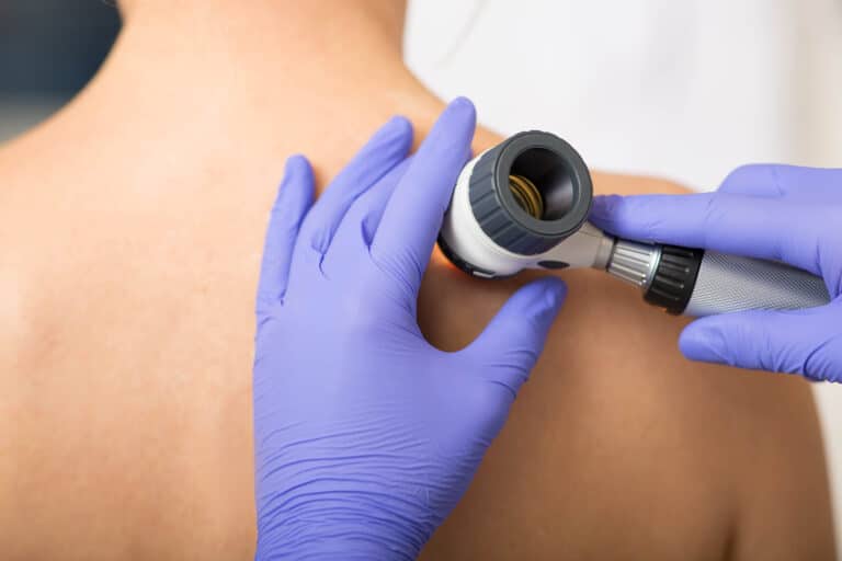 Skin Cancer and Why it is Important to Get an Annual Skin Exam | Skin ...