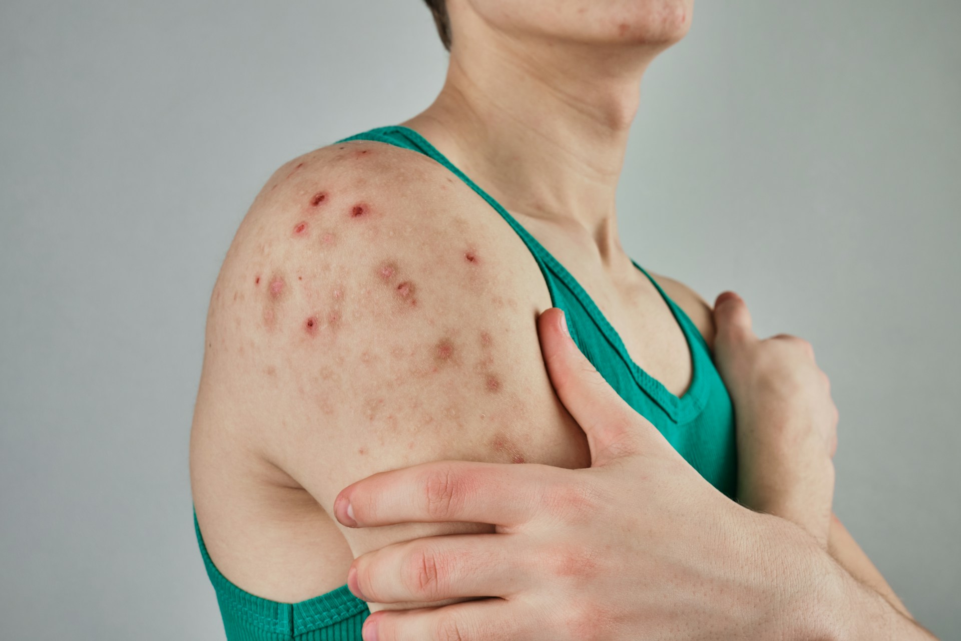 Common Skin Rashes in Phoenix Area: When to See a Dermatologist | Skin ...